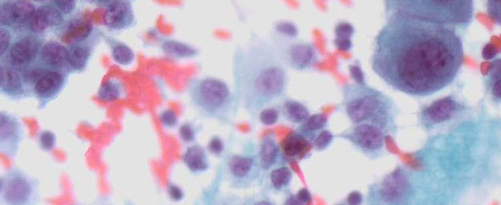 Zytopathologie