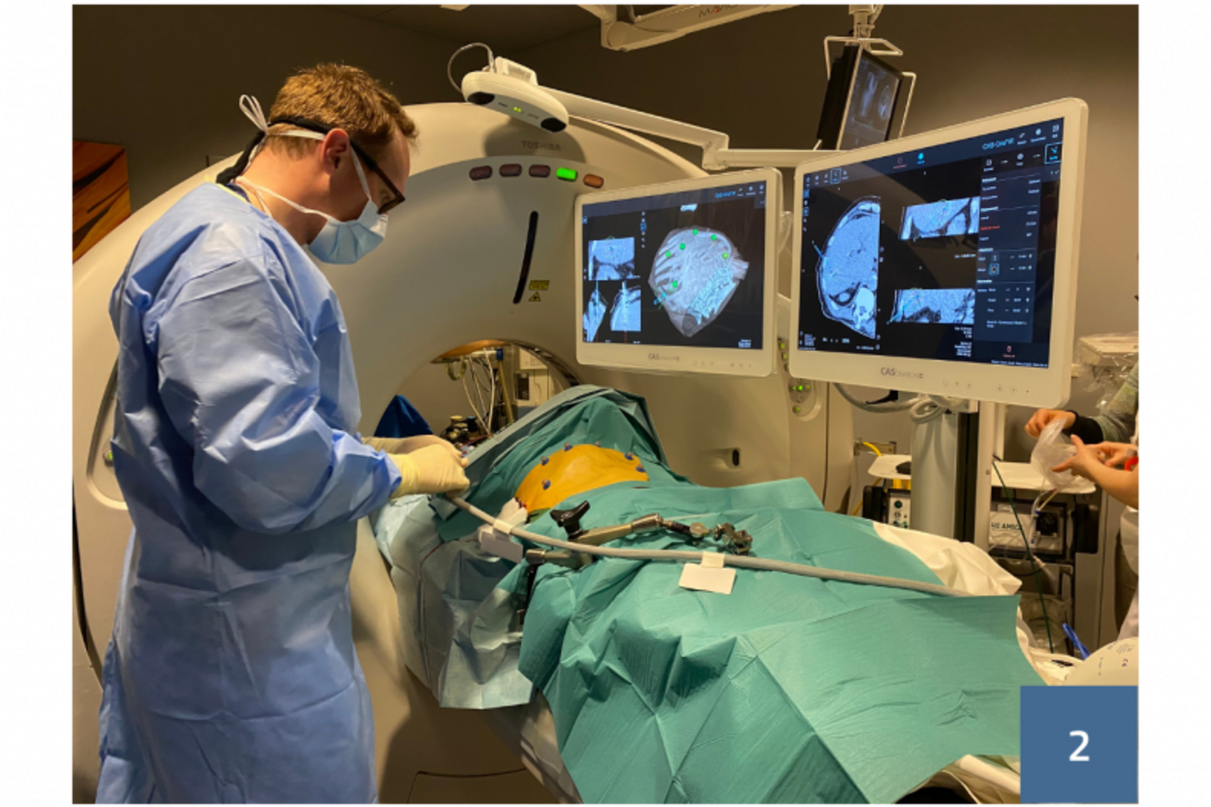 Thermoablation: Tumore mit feiner Nadel verbrennen